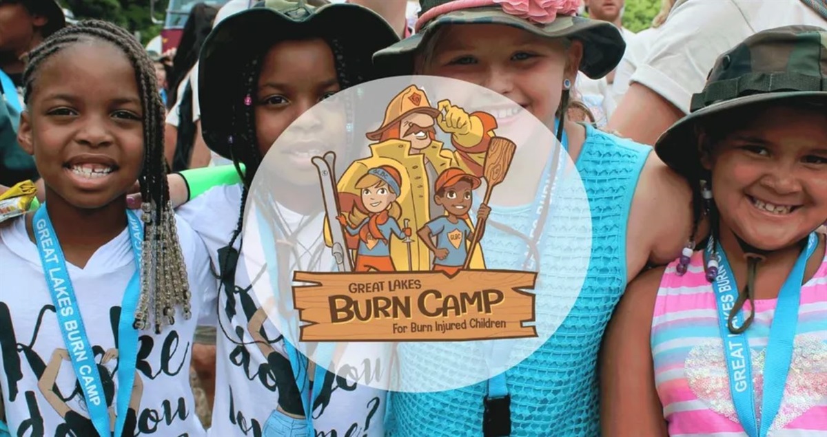 Great Lakes Burn Camp Kalamazoo Public Safety Great Lakes Burn Camp Kalamazoo Public Safety